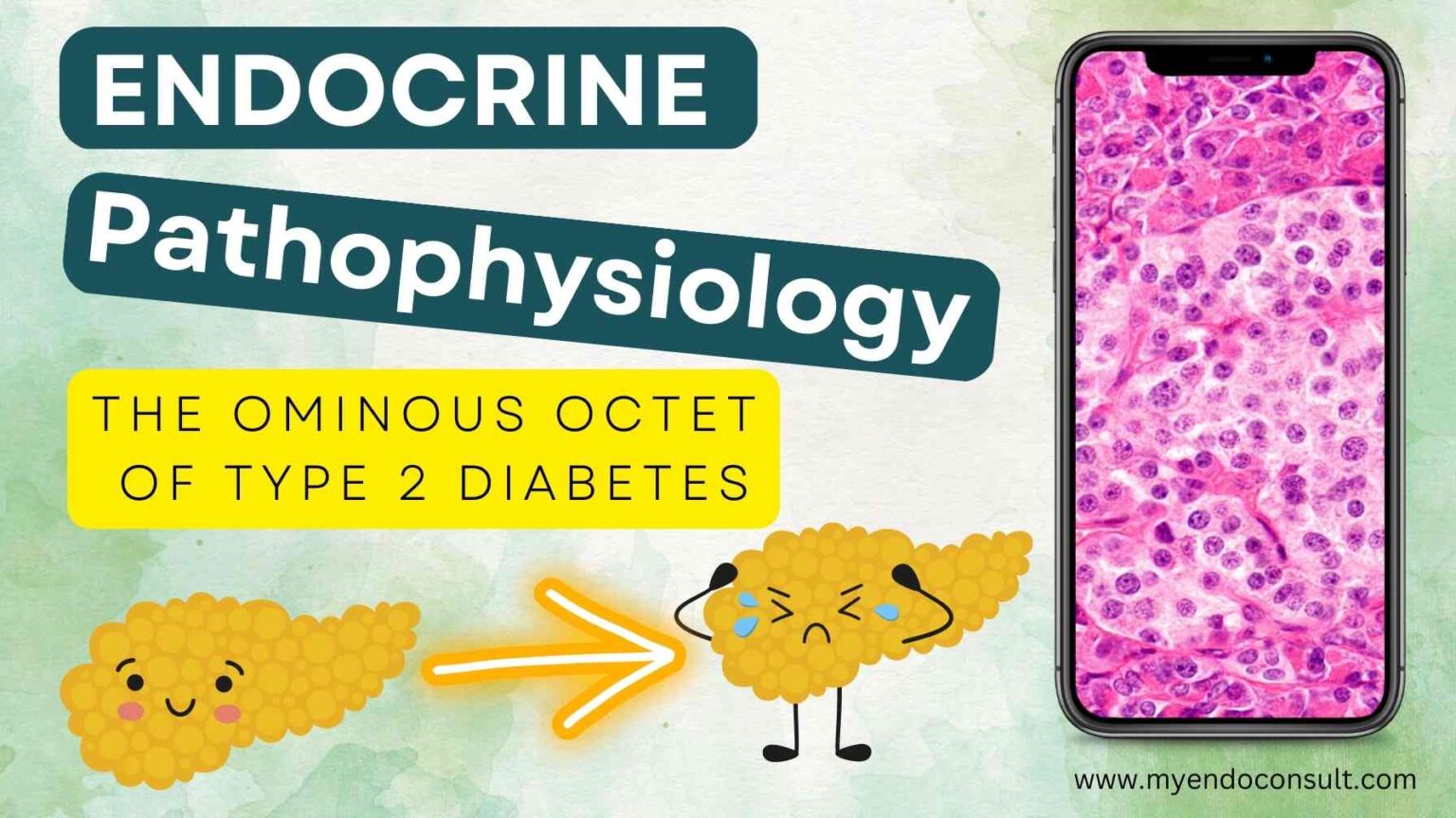 Diabetes Drugs Mnemonics - My Endo Consult